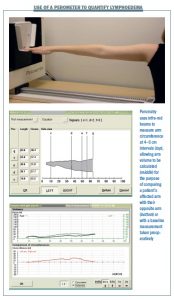 Lymphoedema following treatment for breast cancer: a new approach to an ...